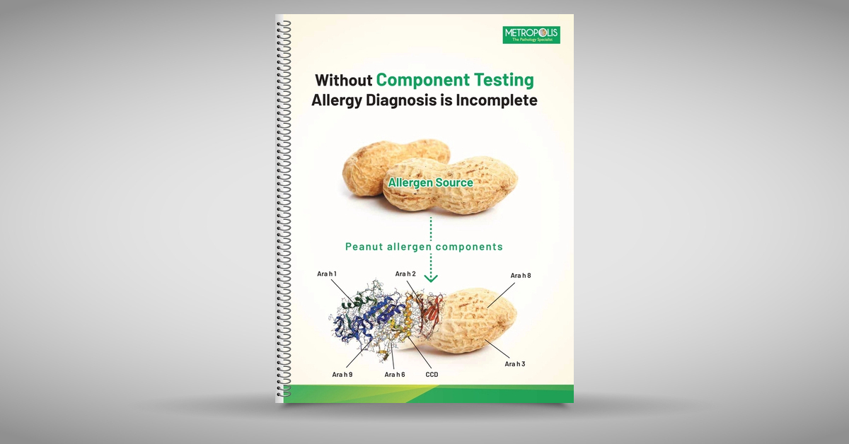 Allergy CRD LBL & Allergy by Miccroarray